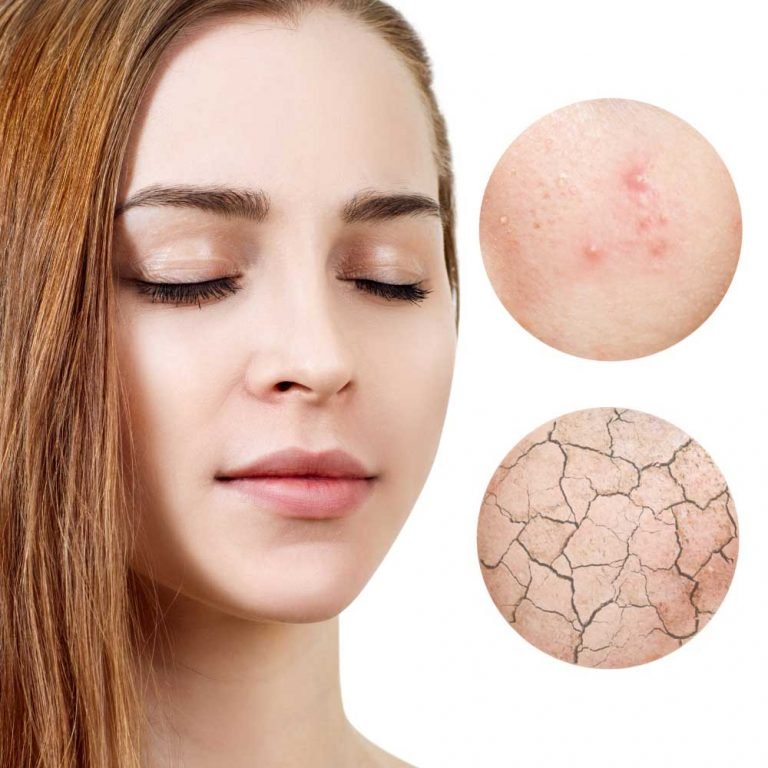 Lo que debe saber de su piel - Revista Maxi Online